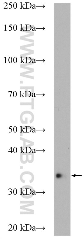 PARP11 antibody (16692-1-AP) | Proteintech