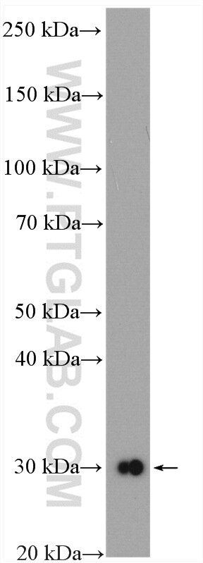 PARP11 Antibody 16692-1-AP | Proteintech