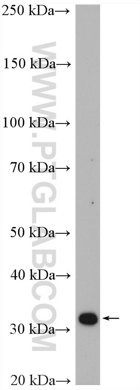 PARP11 antibody (16692-1-AP) | Proteintech
