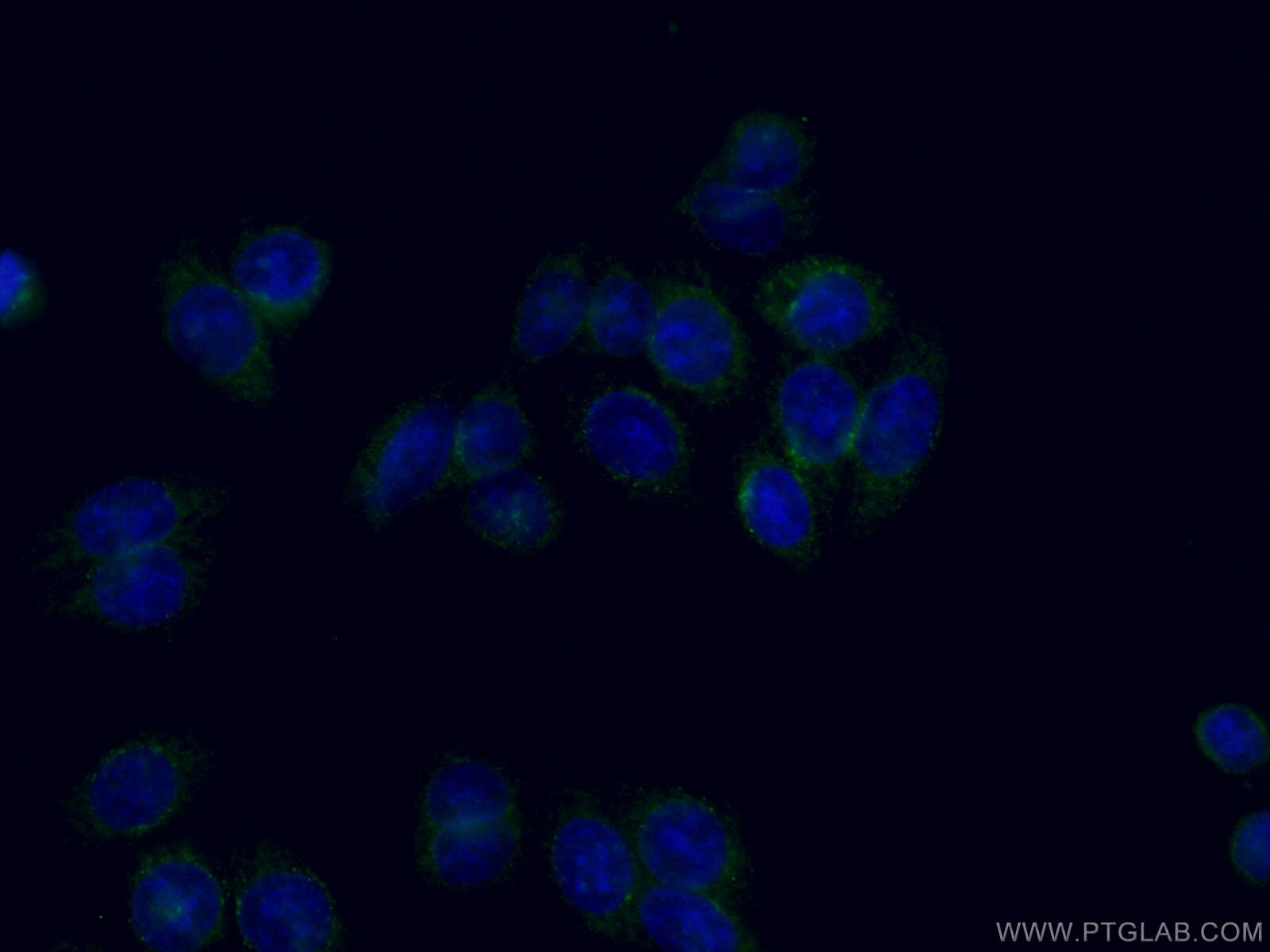 PCK1 antibody (66862-1-Ig) | Proteintech
