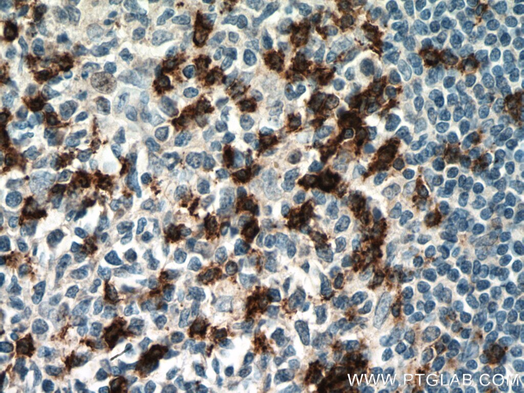 Results for "CD279" | Proteintech Group