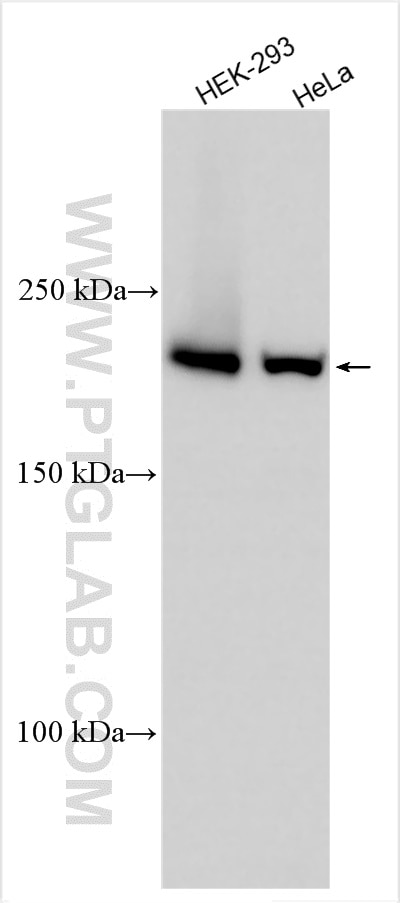 PDCD11 antibody (31405-1-AP) | Proteintech