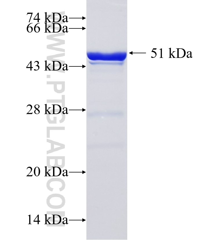 PDCD11 Fusion Protein Ag35402 | Proteintech