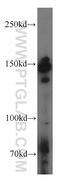 PDS5B Fusion Protein Ag3800 | Proteintech