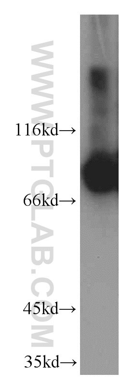 PFKM Fusion Protein Ag30840 | Proteintech