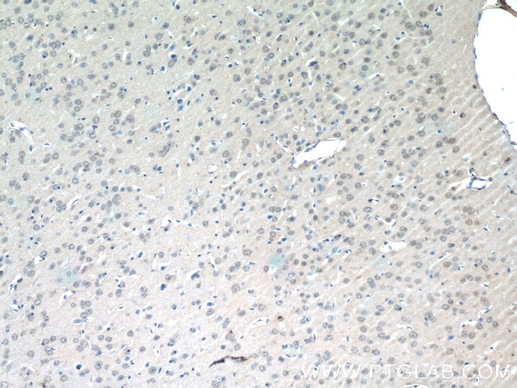 PHOX2B Fusion Protein Ag13196 | Proteintech