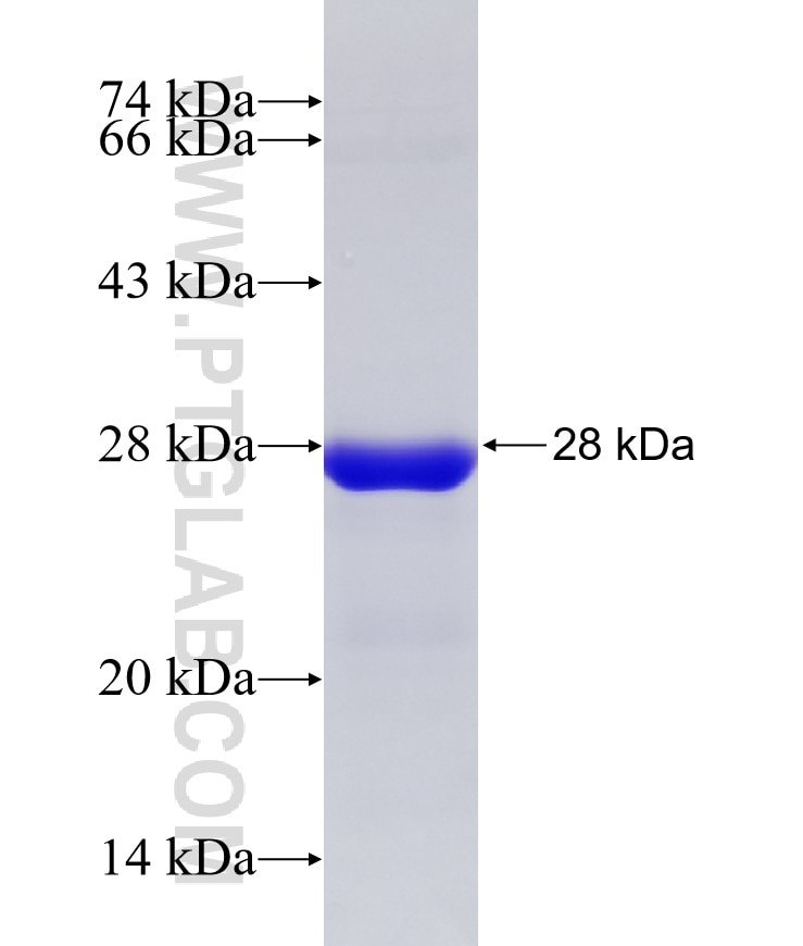 PKHD1 Fusion Protein Ag30443 | Proteintech