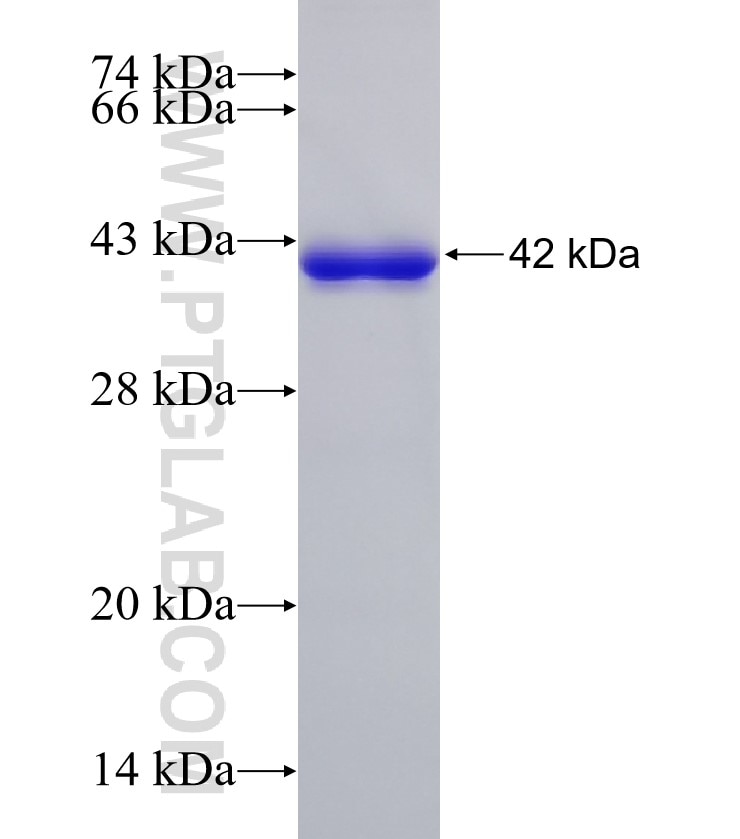 PLEC Fusion Protein Ag33738 | Proteintech