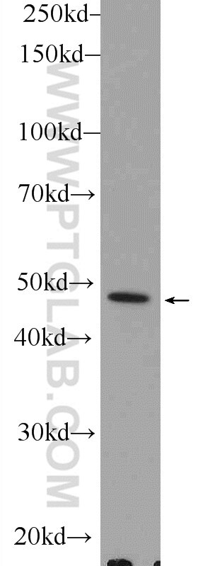 PLEKHO1 Antibody 24883-1-AP | Proteintech