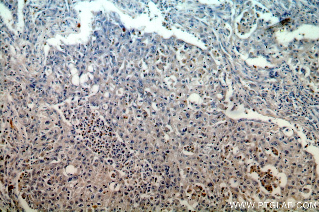 PLK4 antibody (12952-1-AP) | Proteintech