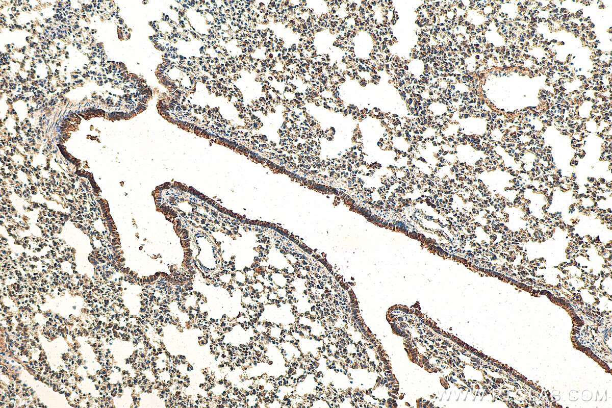 PLUNC antibody (10413-1-AP) | Proteintech