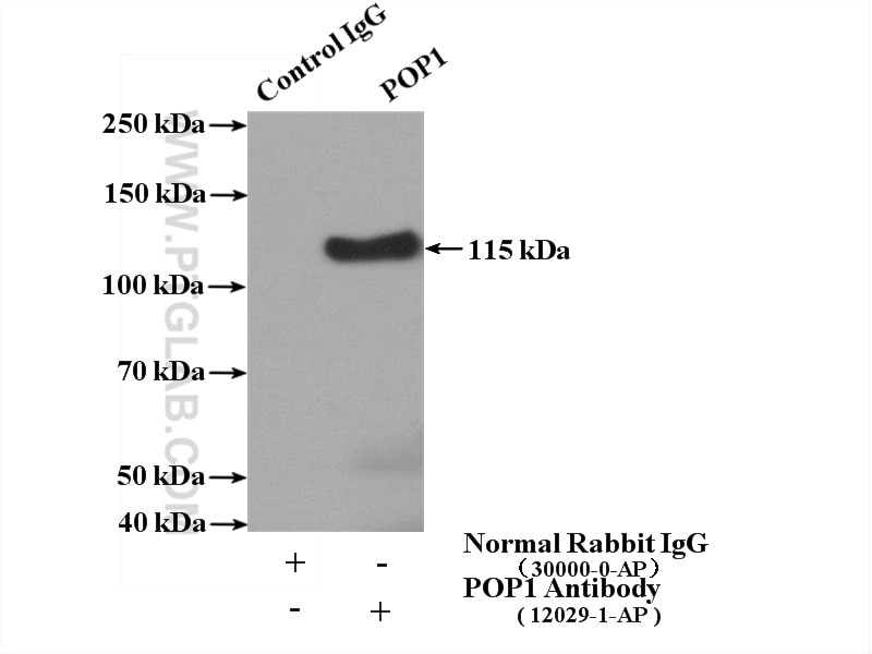 POP1 antibody (12029-1-AP) | Proteintech