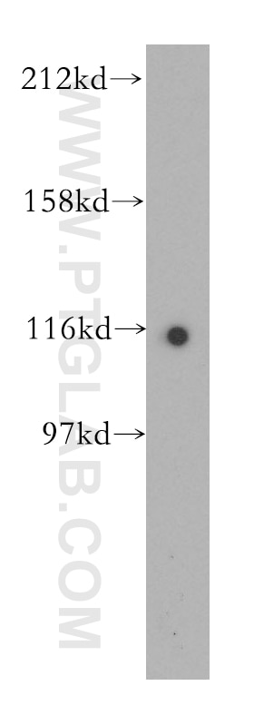 POP1 Fusion Protein Ag2660 | Proteintech