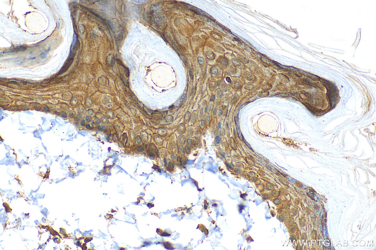 PPL antibody (31296-1-AP) | Proteintech