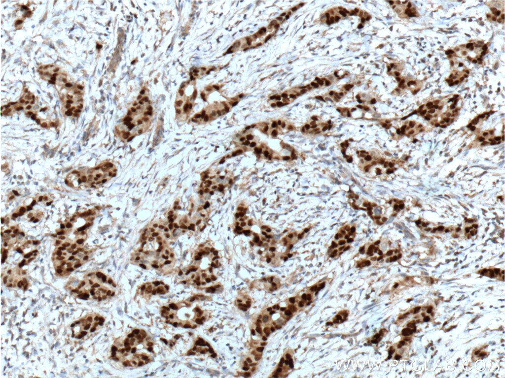 PR antibody (66300-1-Ig) | Proteintech