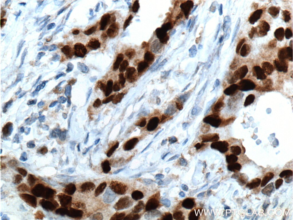 PR antibody (66300-1-Ig) | Proteintech