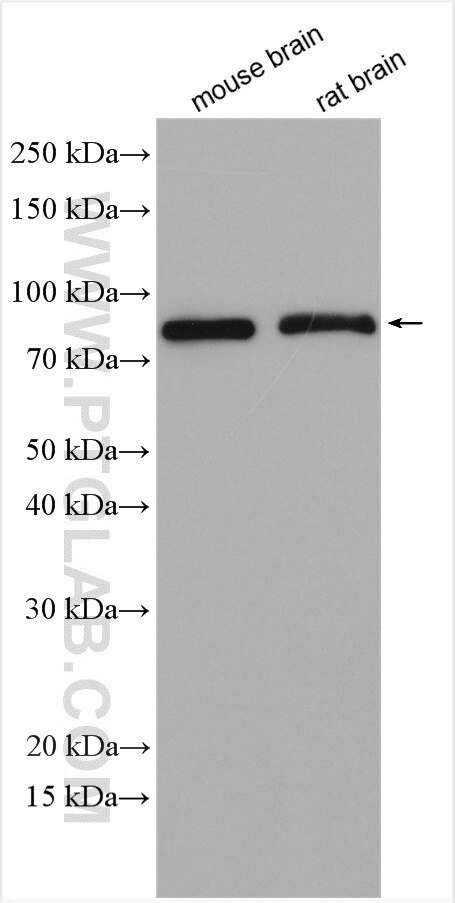 PKC Epsilon antibody (20877-1-AP) | Proteintech