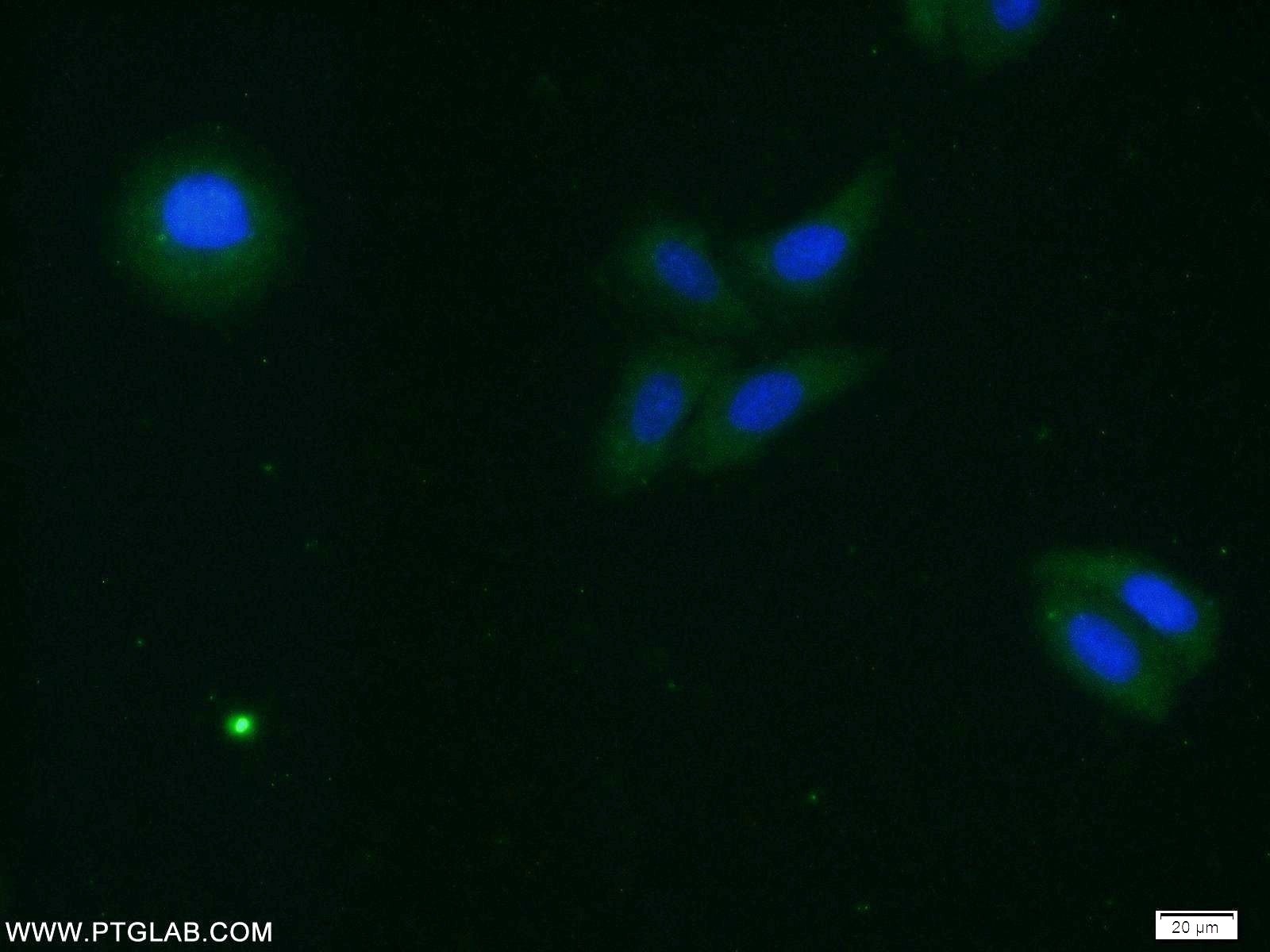 PRDX3 antibody (10664-1-AP) | Proteintech