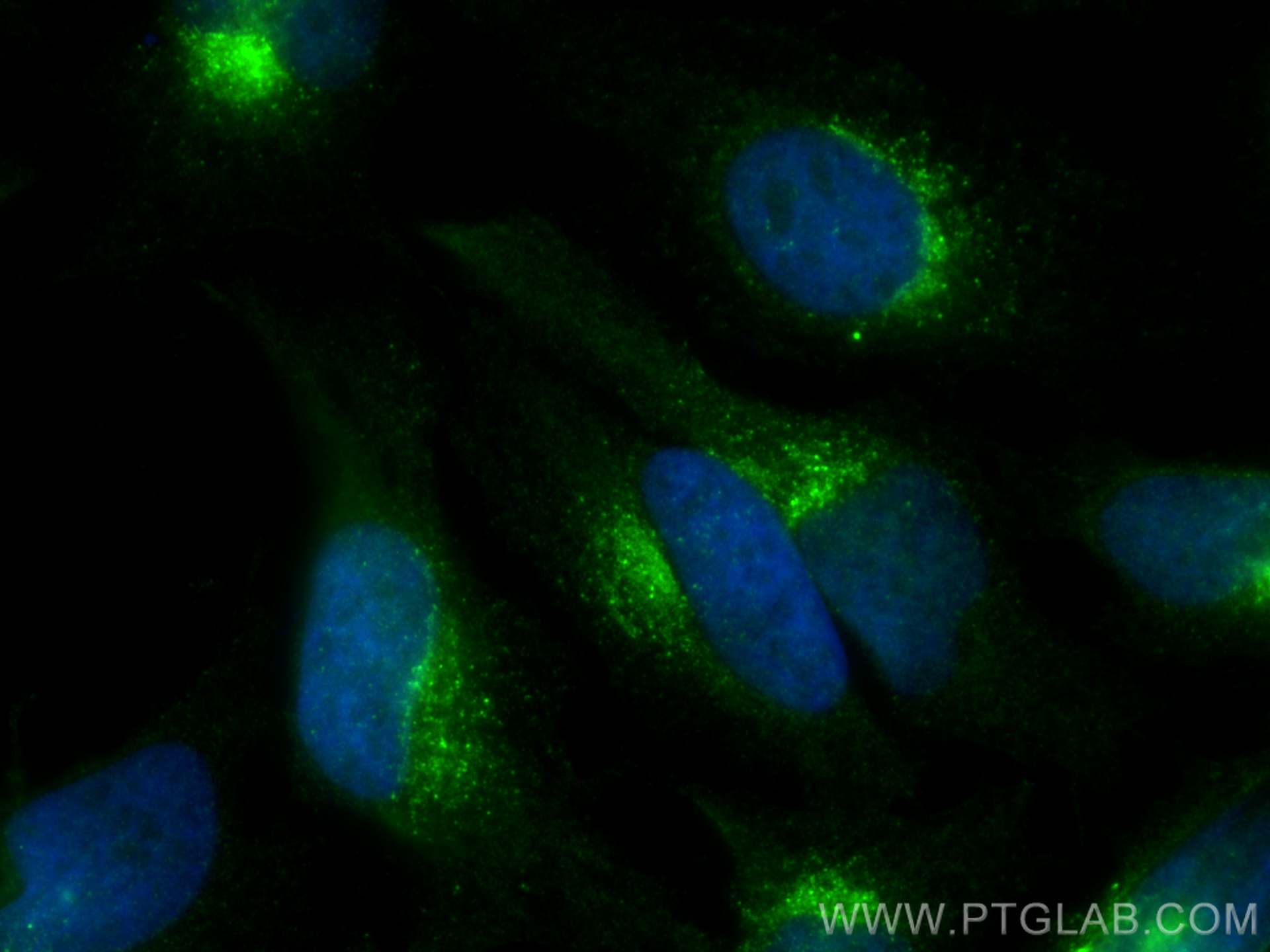 PSAP antibody (10801-1-AP) | Proteintech