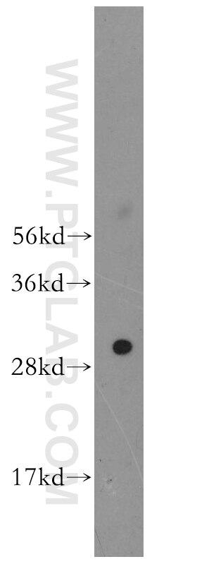 PSMA1 Fusion Protein Ag1660 | Proteintech