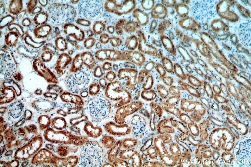 PSPN Fusion Protein Ag16222 | Proteintech
