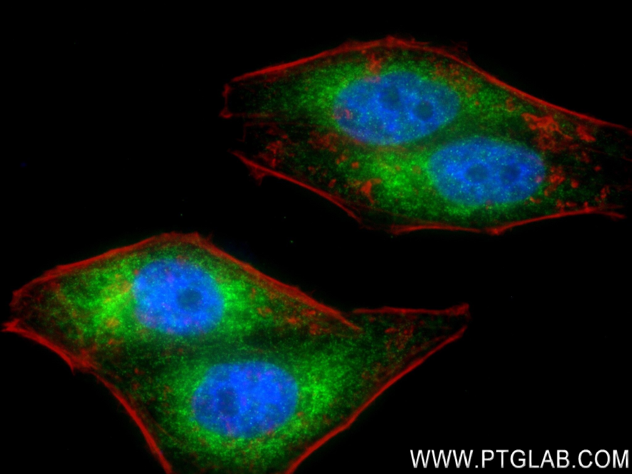 PTDSS1 antibody (83421-1-RR) | Proteintech