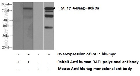 RAF1 Fusion Protein Ag25402 | Proteintech