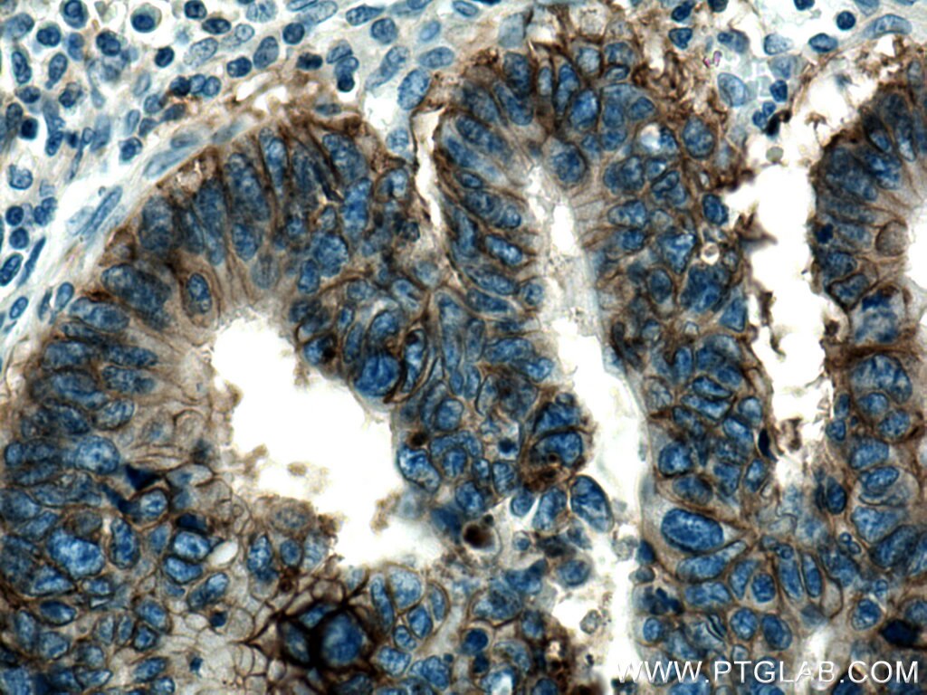ASCT2 antibody (20350-1-AP) | Proteintech
