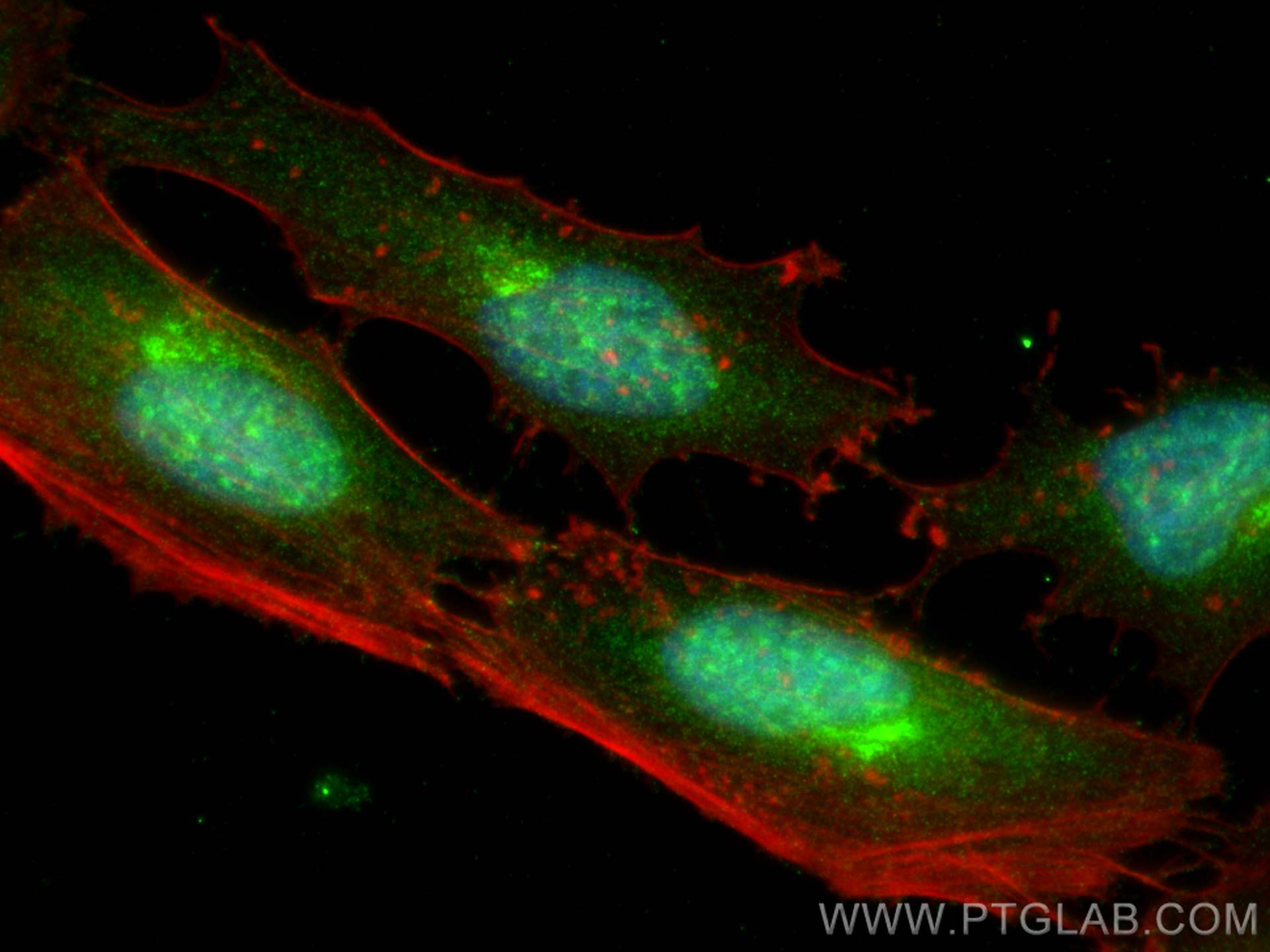 RELB antibody (25027-1-AP) | Proteintech