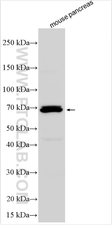 RIPK3 antibody (17563-1-AP) | Proteintech