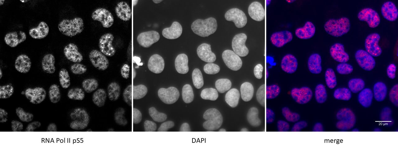 RNA pol II CTD phospho Ser5 antibody (mAb) (Clone 3E8) | Proteintech