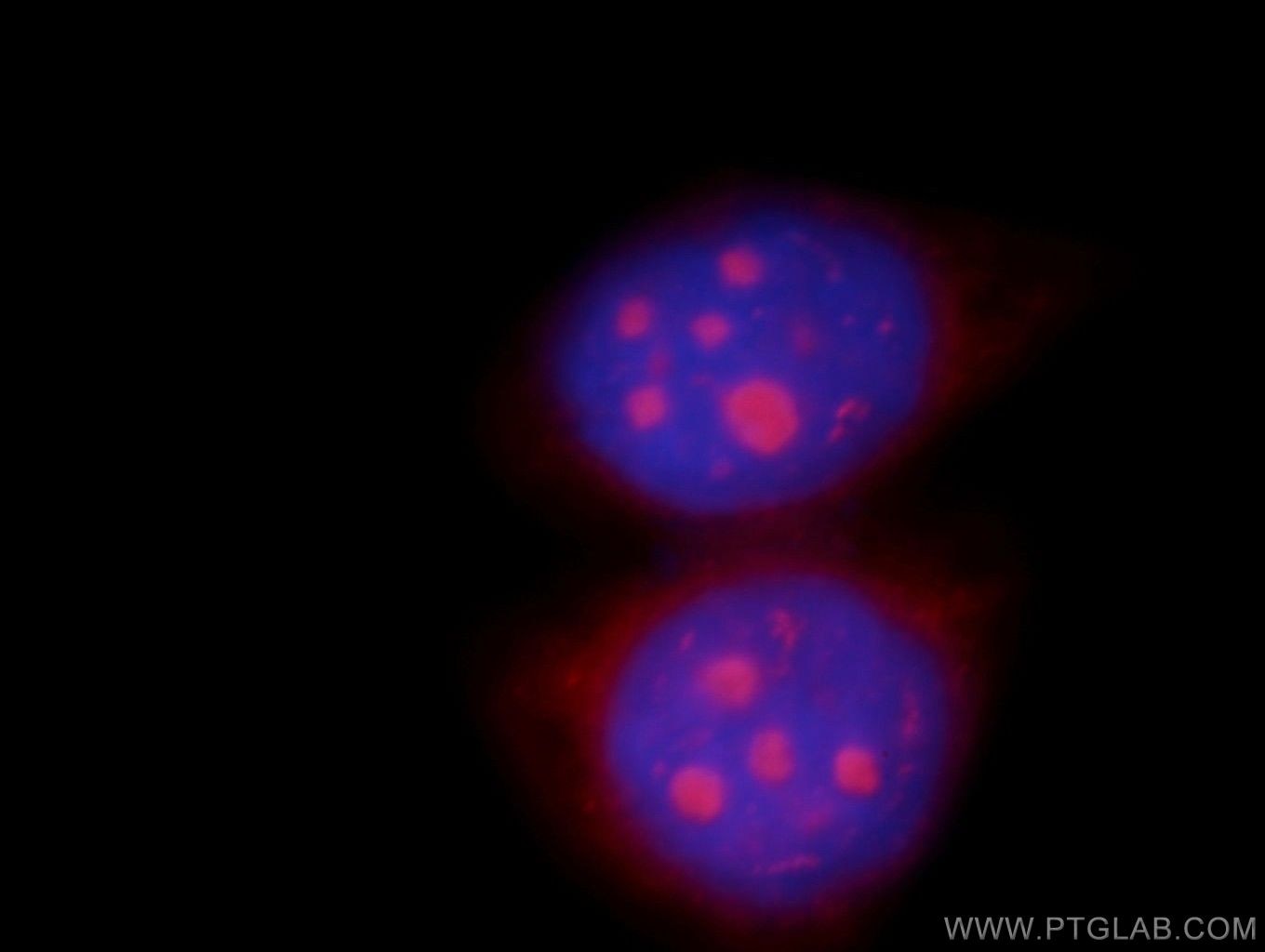 RNF212 Fusion Protein Ag31804 | Proteintech
