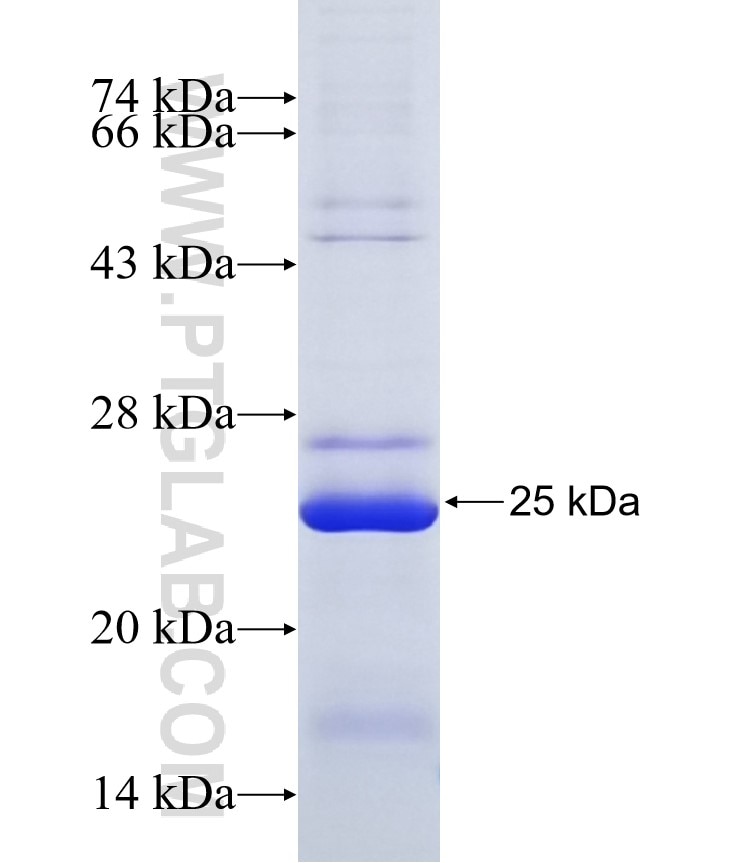 RNF215 Fusion Protein Ag18891 | Proteintech