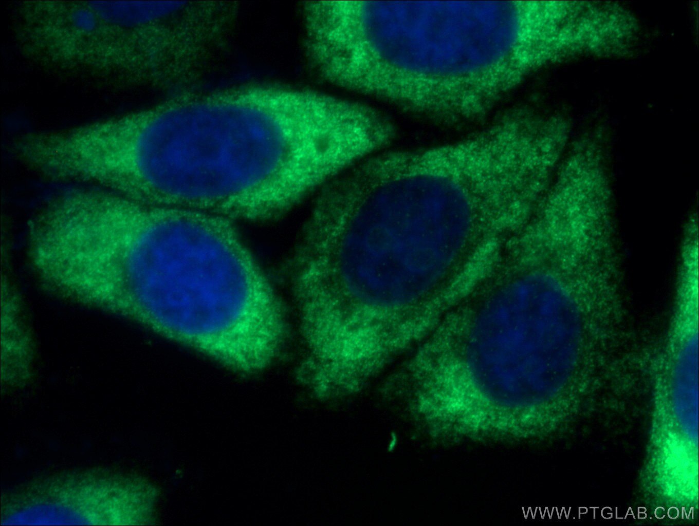 RPL3 antibody (11005-1-AP) | Proteintech