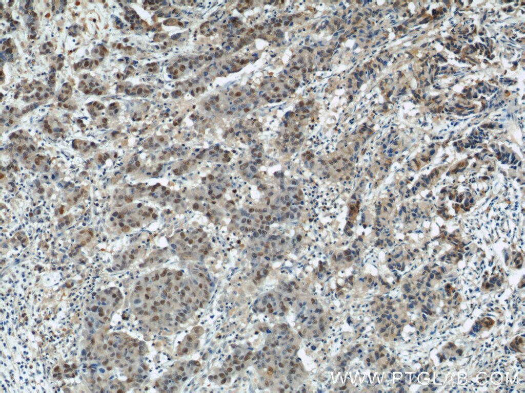 RPL3 antibody (11005-1-AP) | Proteintech