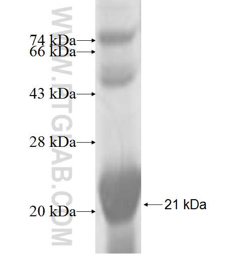 RPS24 Fusion Protein Ag6598 | Proteintech