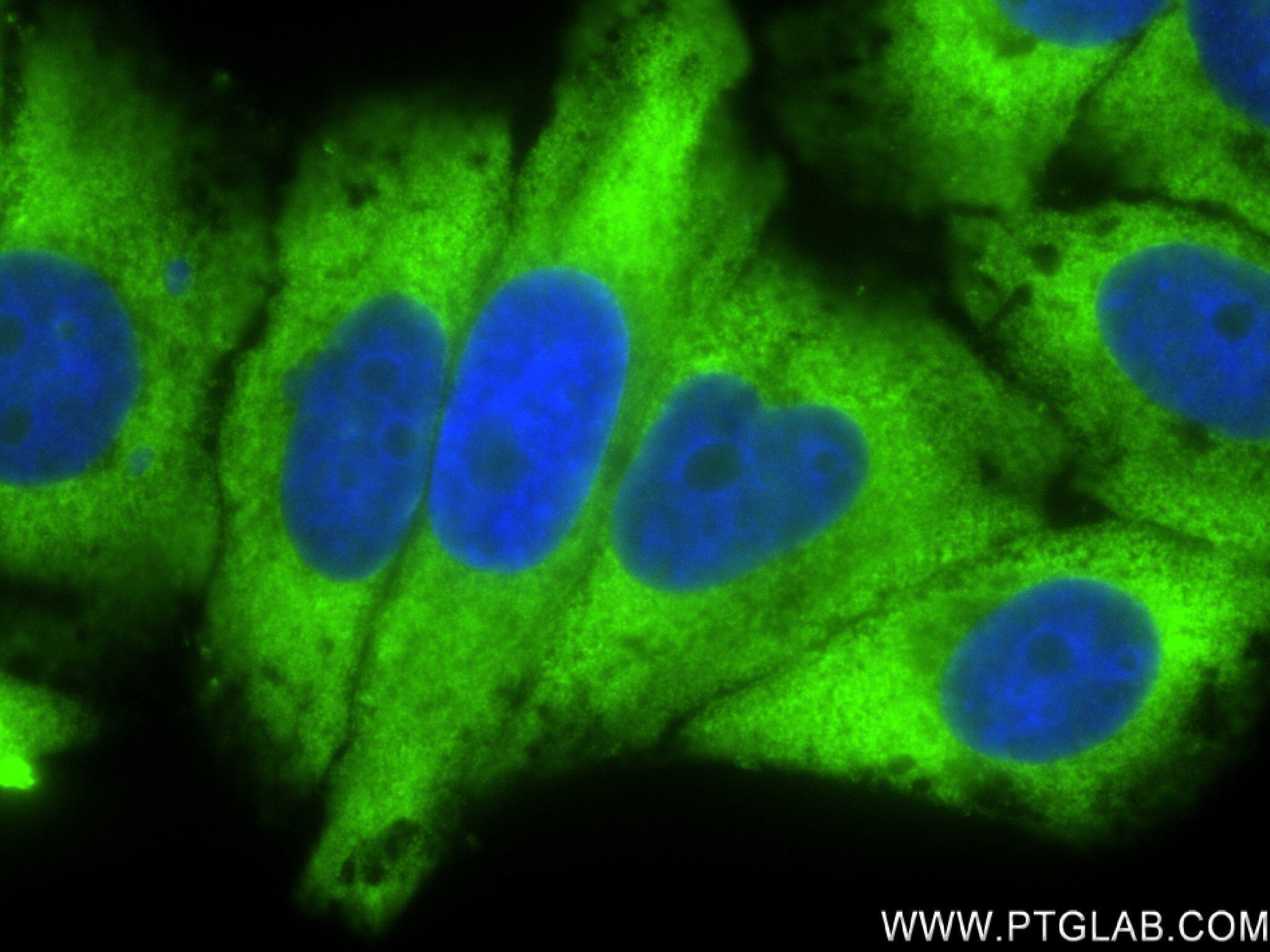 S6 Ribosomal protein antibody (80208-1-RR) | Proteintech