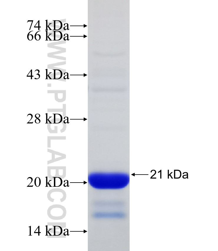 Rad51D Fusion Protein Ag32324 | Proteintech