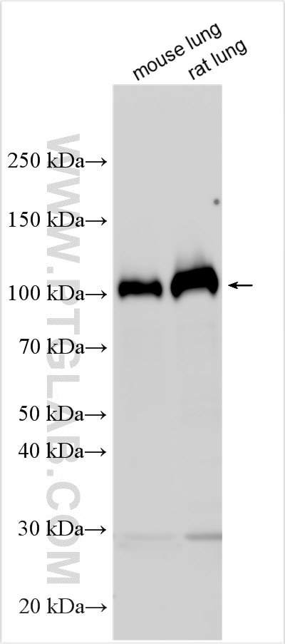 Reck Anticorps (32866-1-AP) | Proteintech