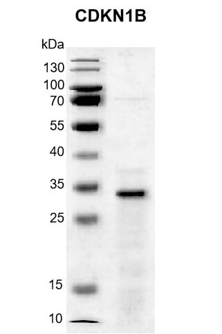 Recombinant CDKN1B protein | Proteintech