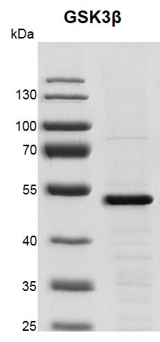Recombinant GSK3b protein | Proteintech