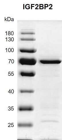 Recombinant IGF2BP2 protein | Proteintech