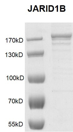 Recombinant JARID1B / KDM5B protein | Proteintech