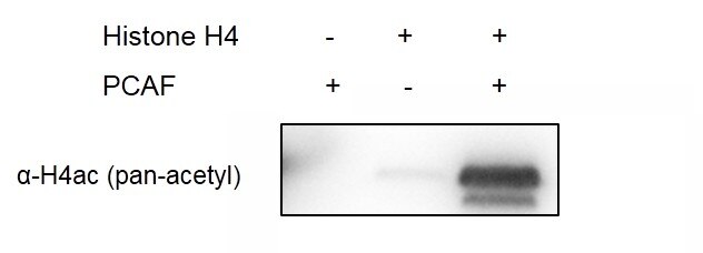 Recombinant KAT2B / PCAF protein | Proteintech