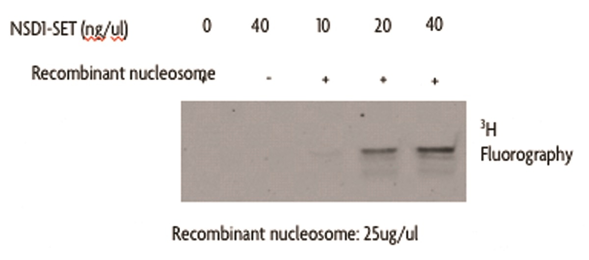 Recombinant NSD1-SET protein | Proteintech
