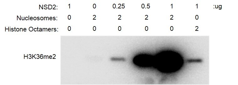 Recombinant NSD2 (MMSET) protein | Proteintech
