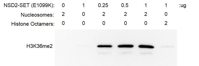 Recombinant NSD2-SET (E1099K) protein | Proteintech
