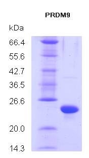 Recombinant PRDM9 (191-414) protein | Proteintech