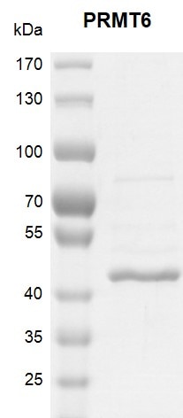 Recombinant PRMT6 protein | Proteintech