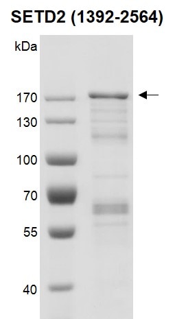 Recombinant SETD2 (1392-2564) protein | Proteintech